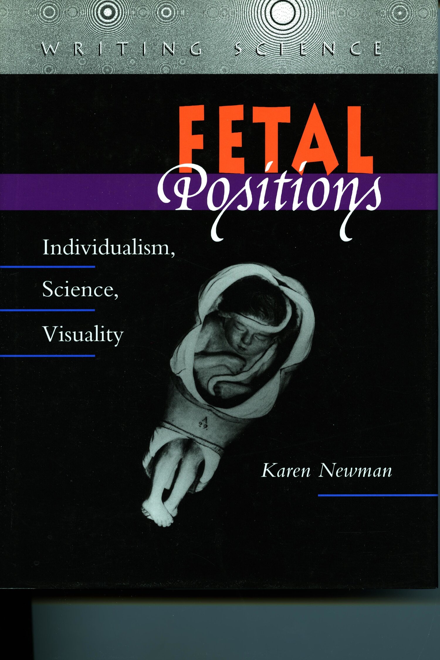 Fetal Positions | Stanford University Press